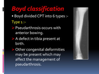 Congenital pseudarthrosis of tibia (CVT) | PPTX | Death, Injury, or ...