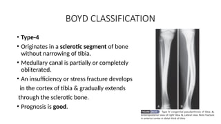 CONGENITAL PSEUDO ARTHROSIS OF TIBIA-1.pptx