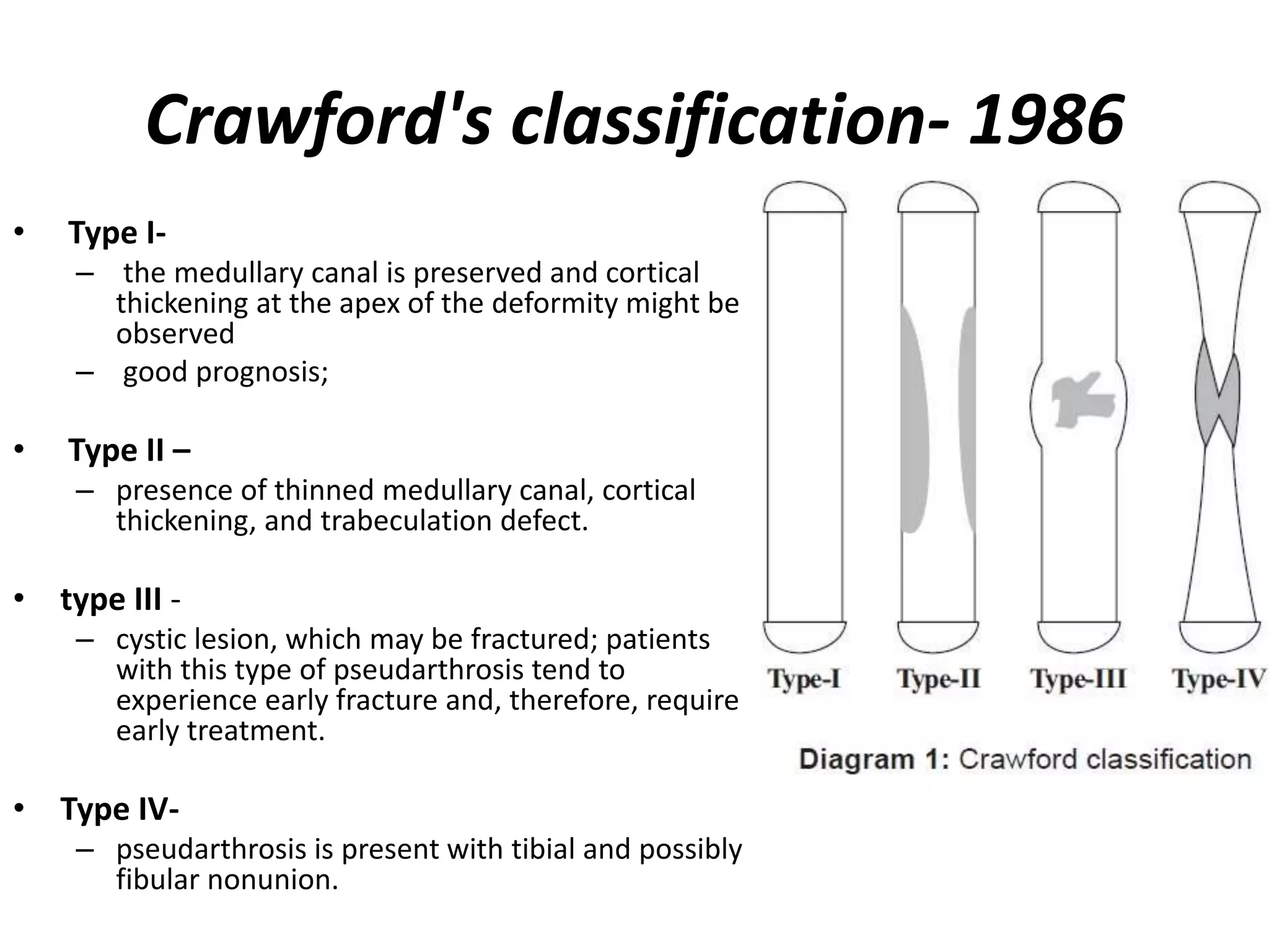 Congenital pseudo arthrosis of tibia | PPTX