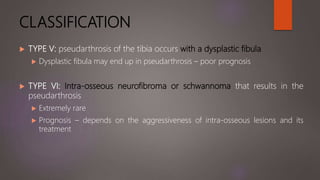 Congenital pseudarthrosis of tibia - Dr. Sachin M | PPTX