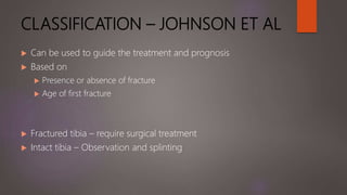 Congenital pseudarthrosis of tibia - Dr. Sachin M | PPTX