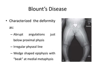 Congenital Pseudoarthrosis of Tibia and Blounte’s Disease.pptx