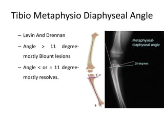 Congenital Pseudoarthrosis of Tibia and Blounte’s Disease.pptx