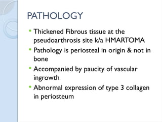 CONGENITAL PSEUDO ARTHROSIS OF TIBIA jainam.pptx