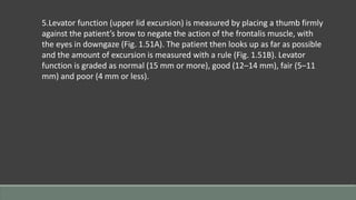 Congenital ptosis | PPTX