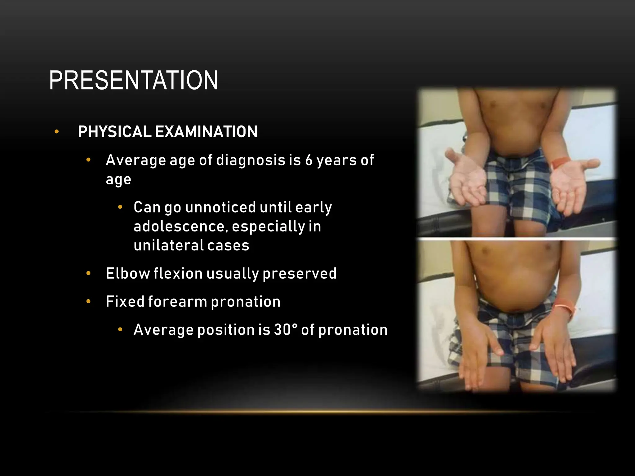 Congenital Radial Ulnar Synostosis.pptx