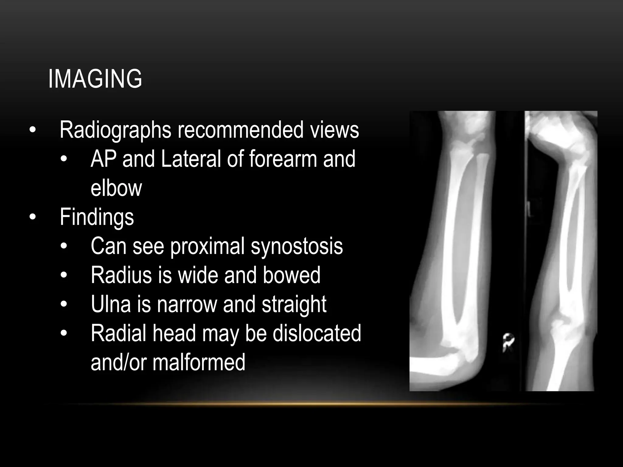 Congenital Radial Ulnar Synostosis.pptx