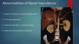 Congenital renal anomalies | PPTX