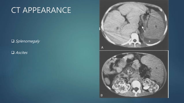 Congenital renal anomalies | PPTX