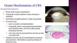 Congenital rubella syndrome | PPTX