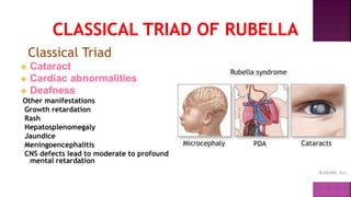 congenitalrubellasyndrome-170330143627 (1).pdf