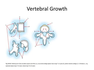 Congenital scoliosis | PPTX