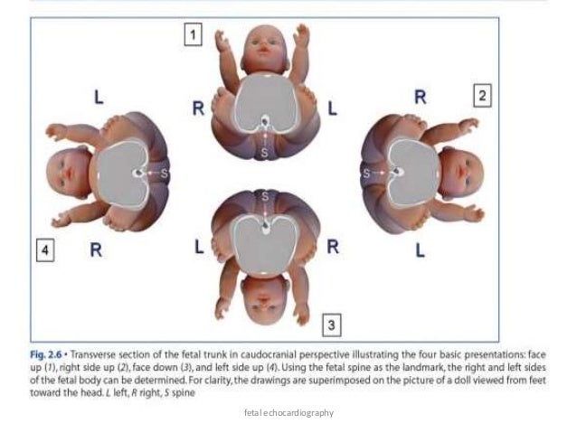 Fetal Echocardiography