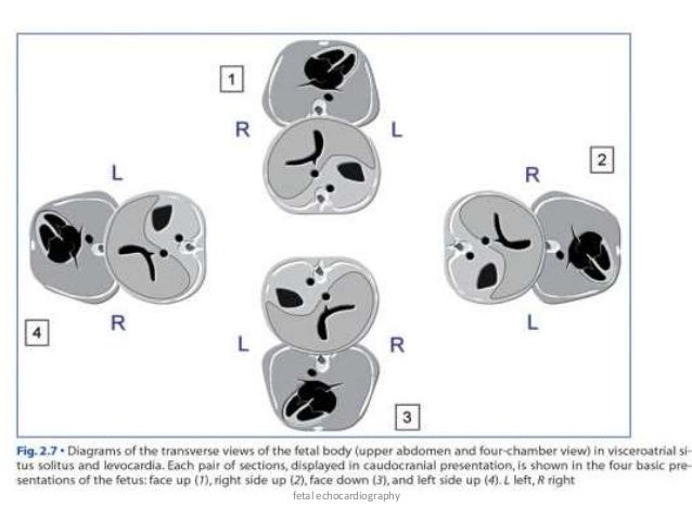 Fetal Echocardiography