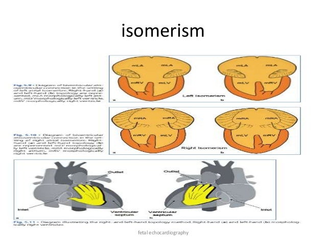 Fetal Echocardiography