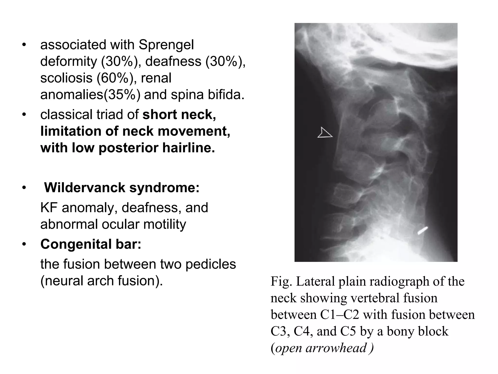 Congenital skeletal anomalies | PPTX