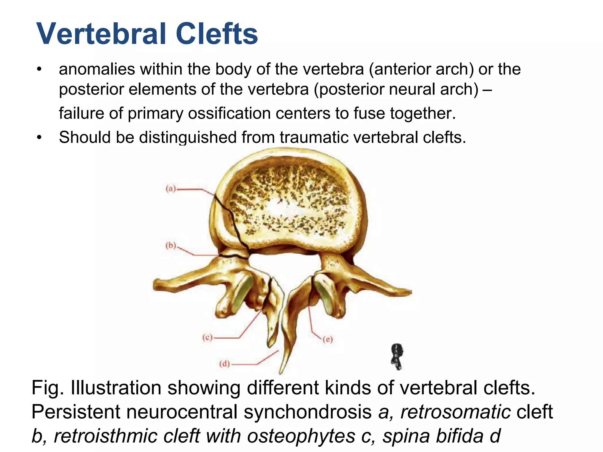 Congenital skeletal anomalies | PPTX