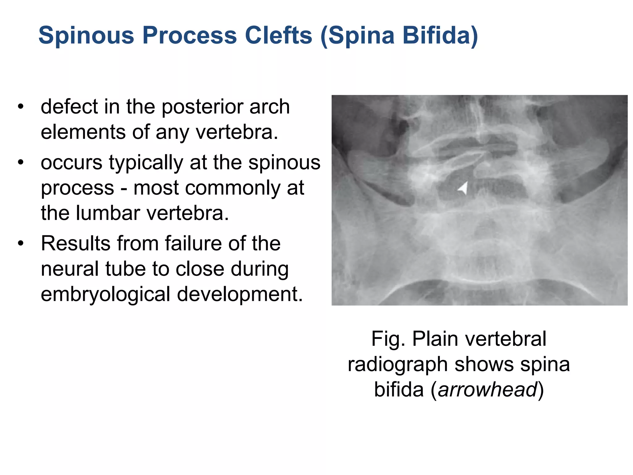 Congenital skeletal anomalies | PPTX