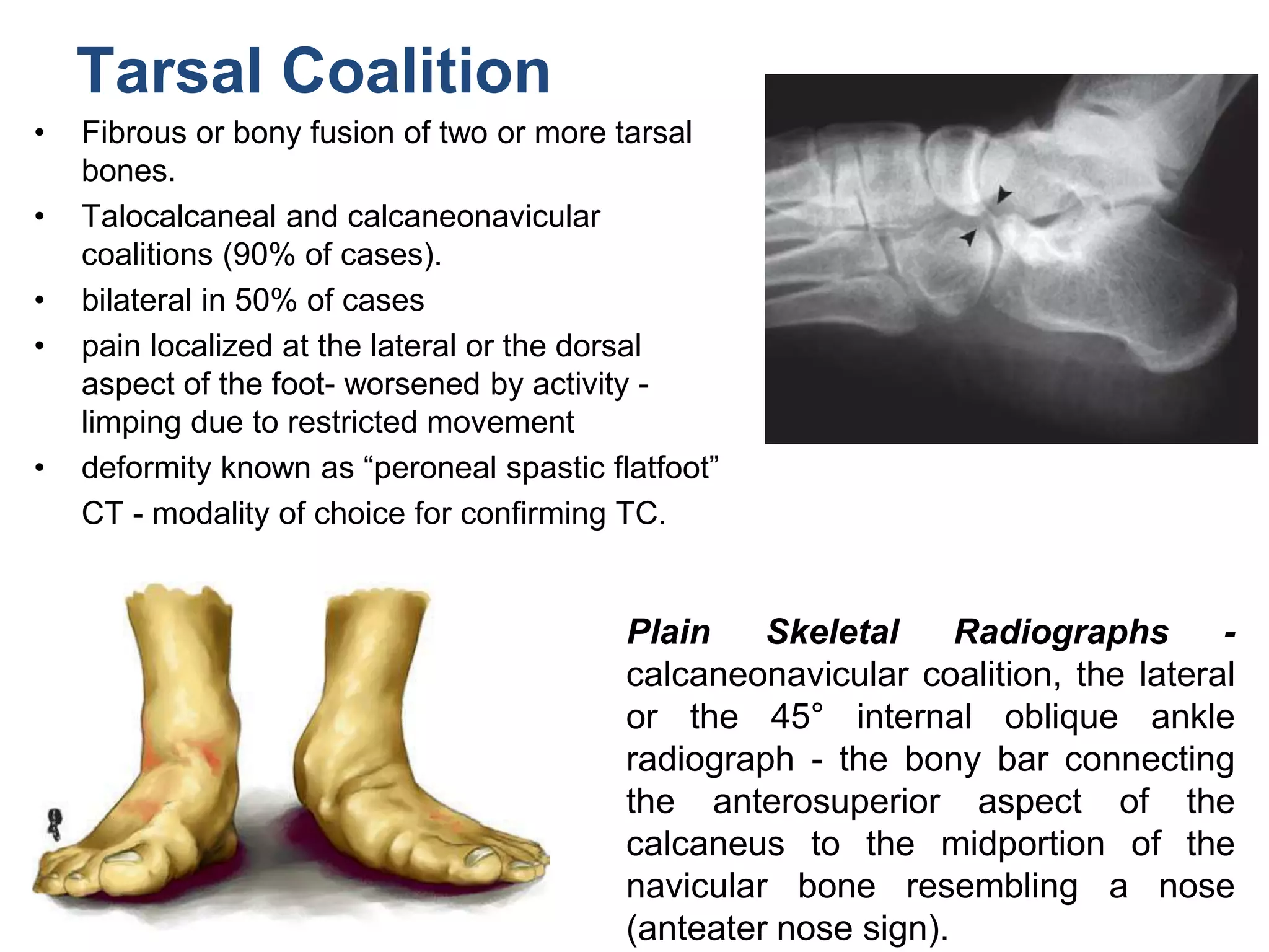 Congenital skeletal anomalies | PPTX