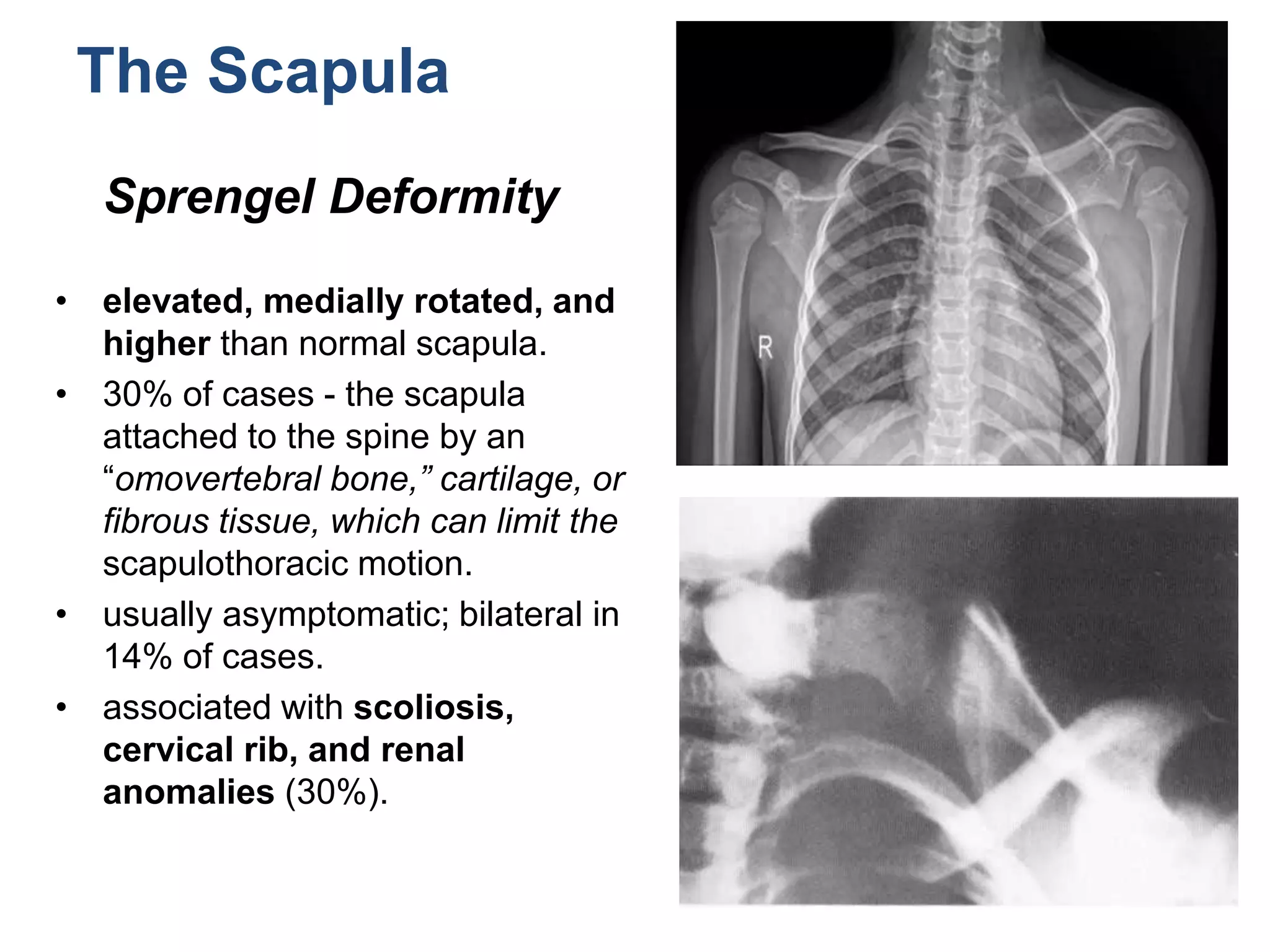 Congenital skeletal anomalies | PPTX