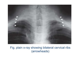 Congenital skeletal anomalies | PPTX
