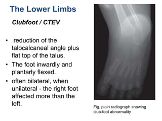 Congenital skeletal anomalies | PPTX