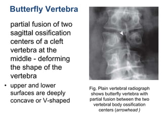 Congenital skeletal anomalies | PPTX
