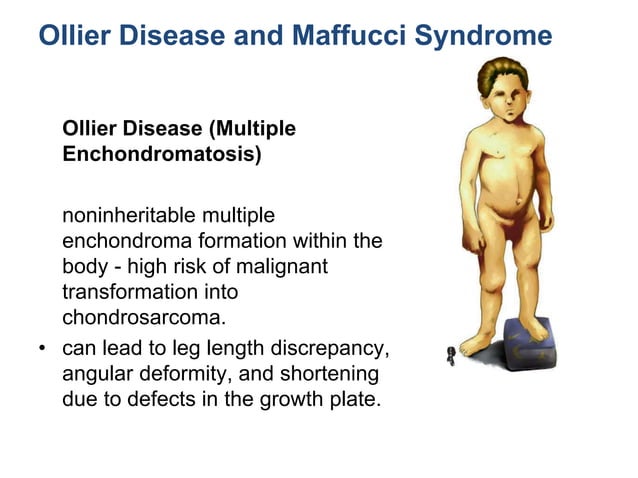 Congenital skeletal anomalies | PPTX | Death, Injury, or Military ...