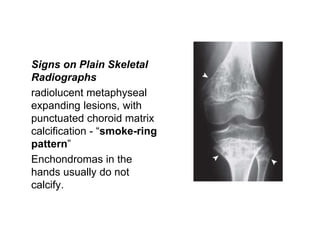 Congenital skeletal anomalies | PPTX