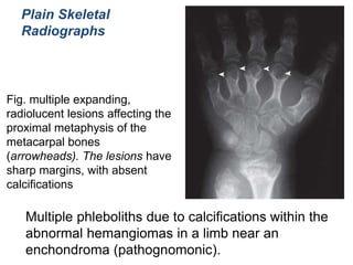 Congenital skeletal anomalies | PPTX