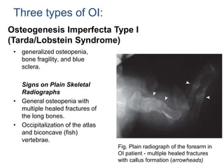 Congenital skeletal anomalies | PPTX