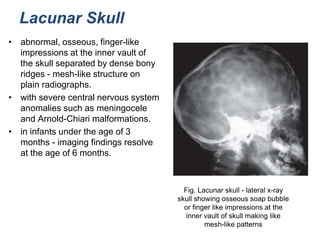 Congenital skeletal anomalies | PPTX