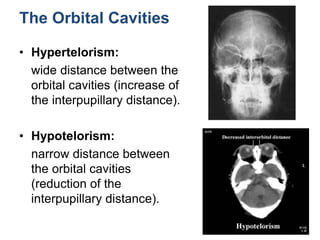 Congenital skeletal anomalies | PPTX