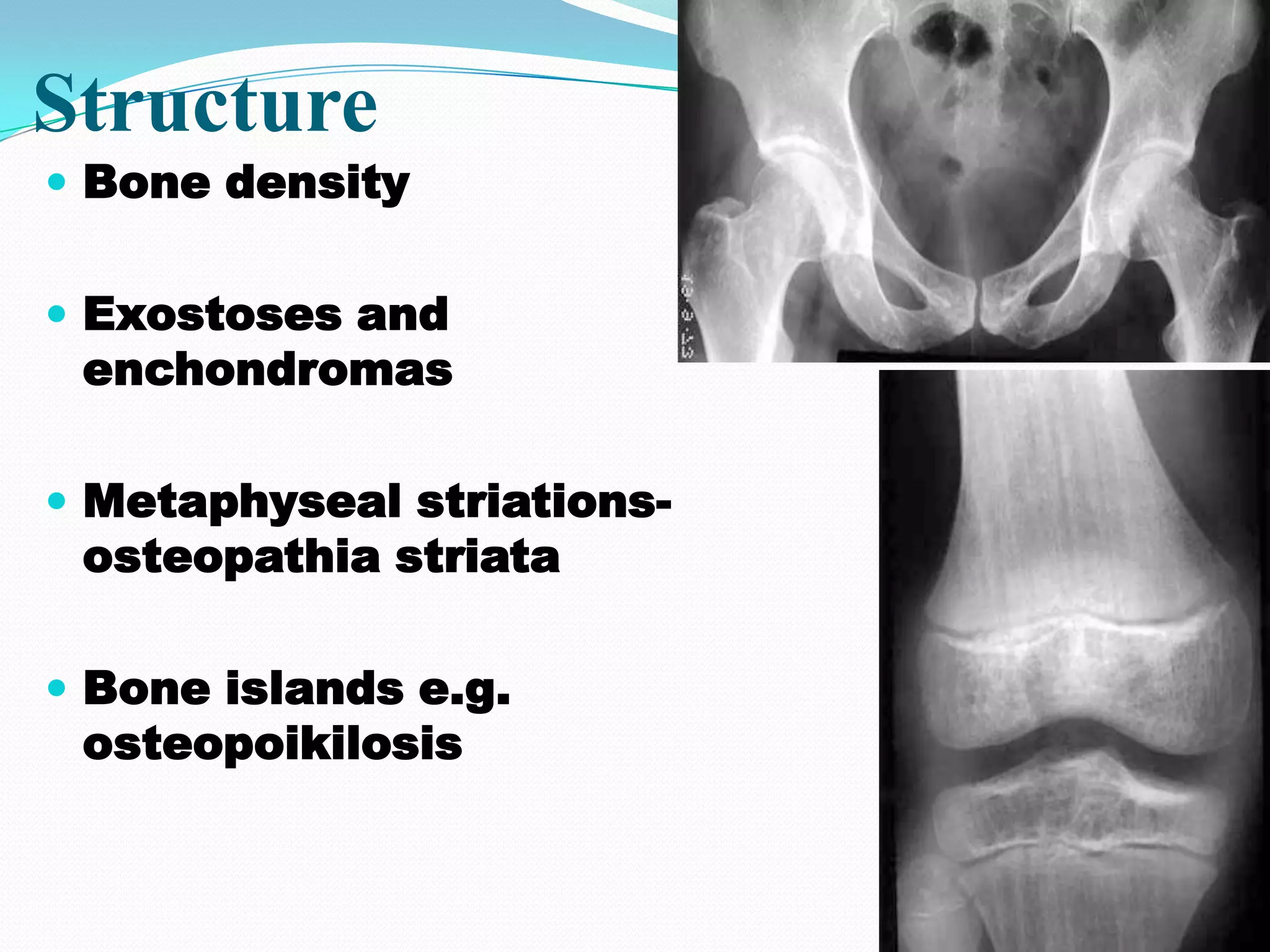 Radiological approach to Congenital skeletal dysplasia | PPTX