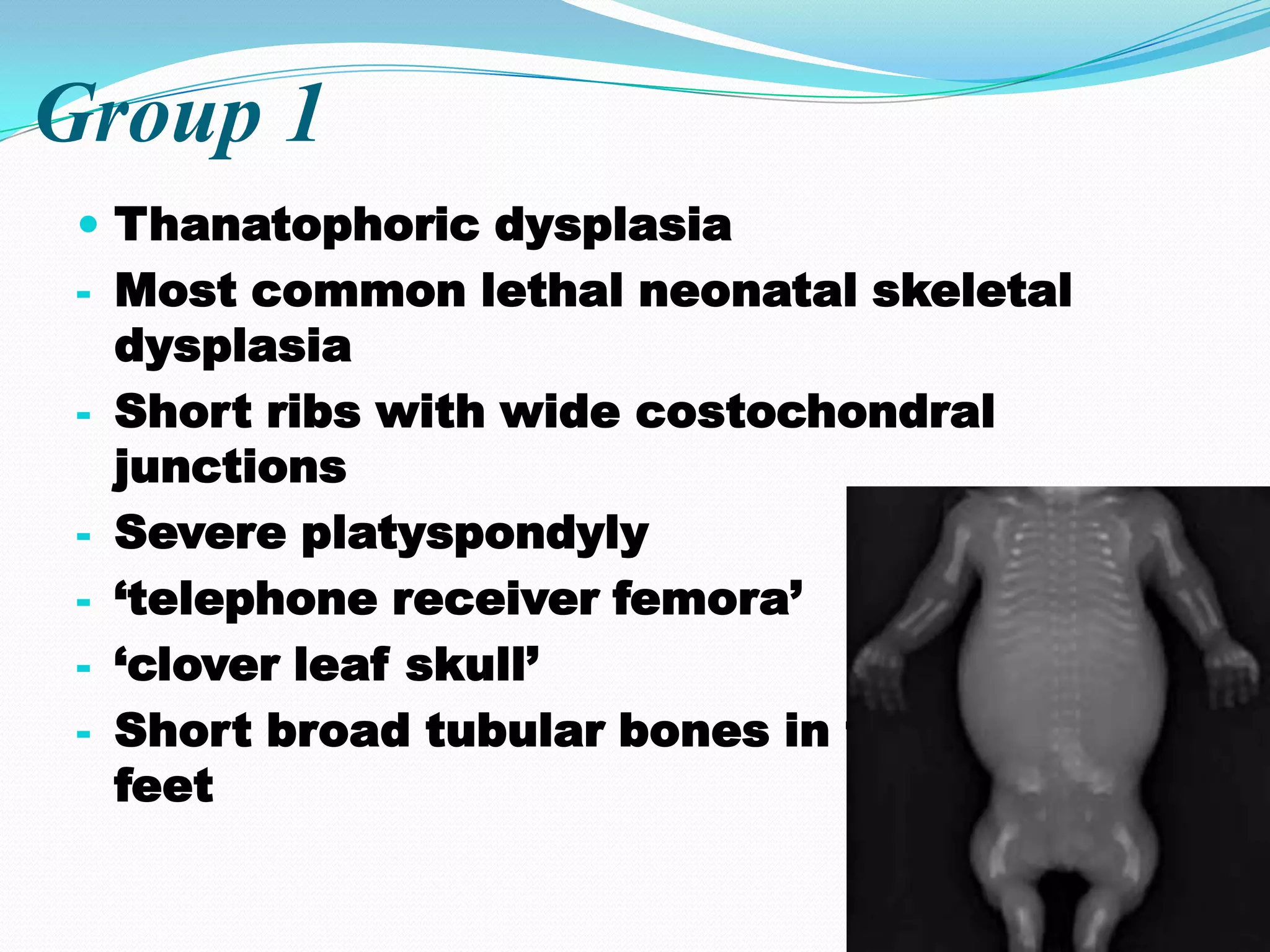 Radiological approach to Congenital skeletal dysplasia | PPTX