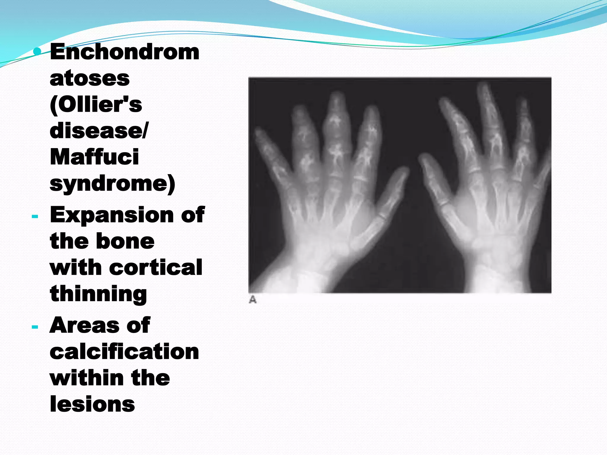Radiological approach to Congenital skeletal dysplasia | PPTX