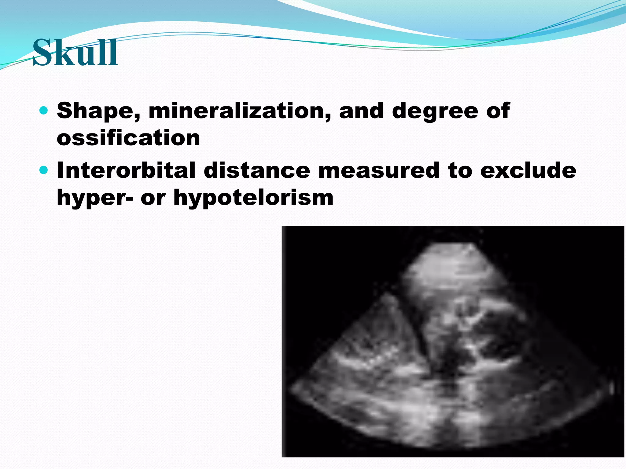 Radiological approach to Congenital skeletal dysplasia | PPTX