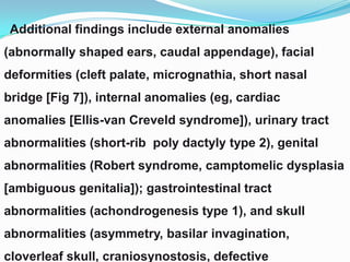 imaging in intrauterine skeletal dysplasia | PPTX
