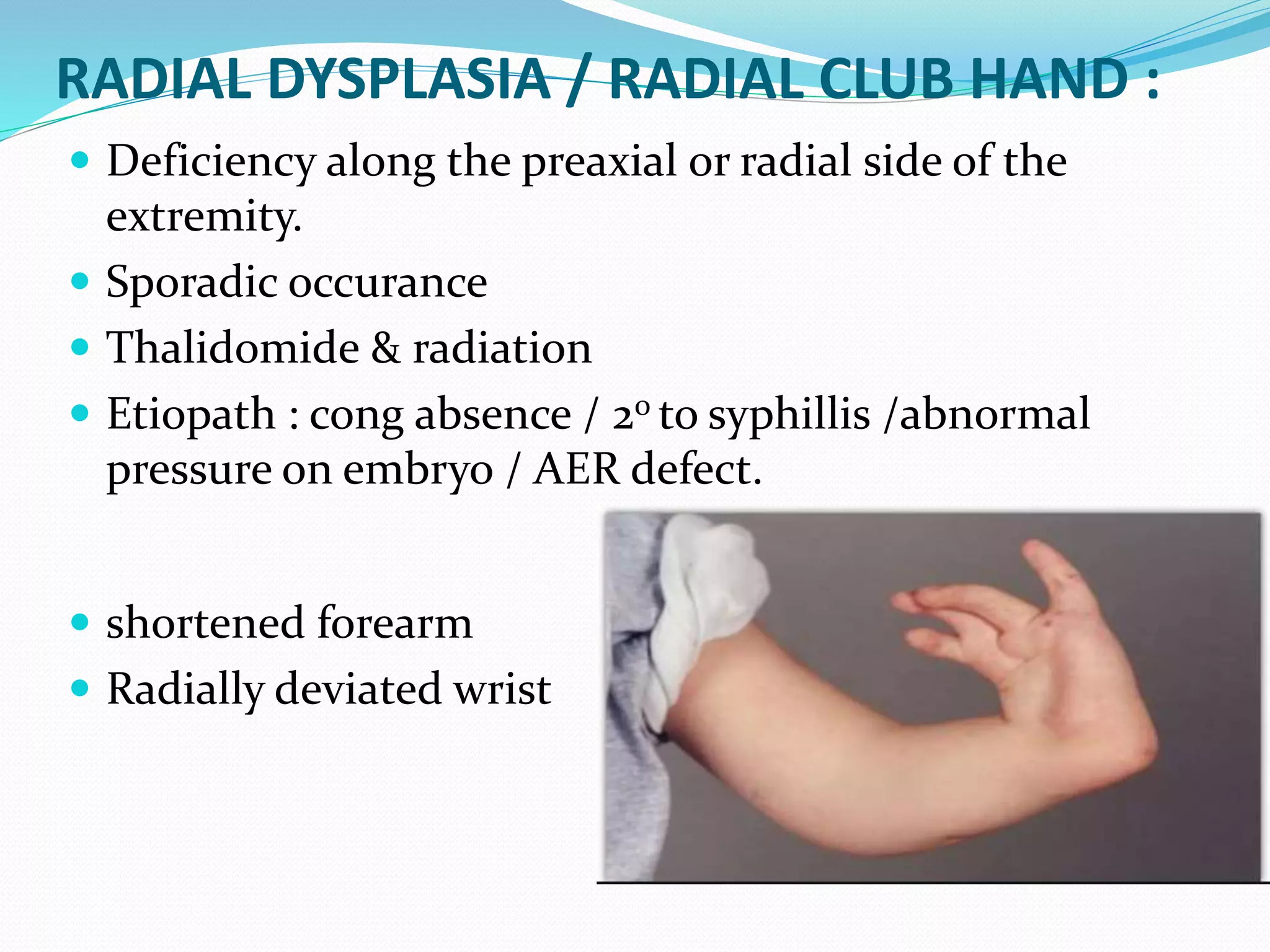 Congenital skeletal limb deficiences | PPTX