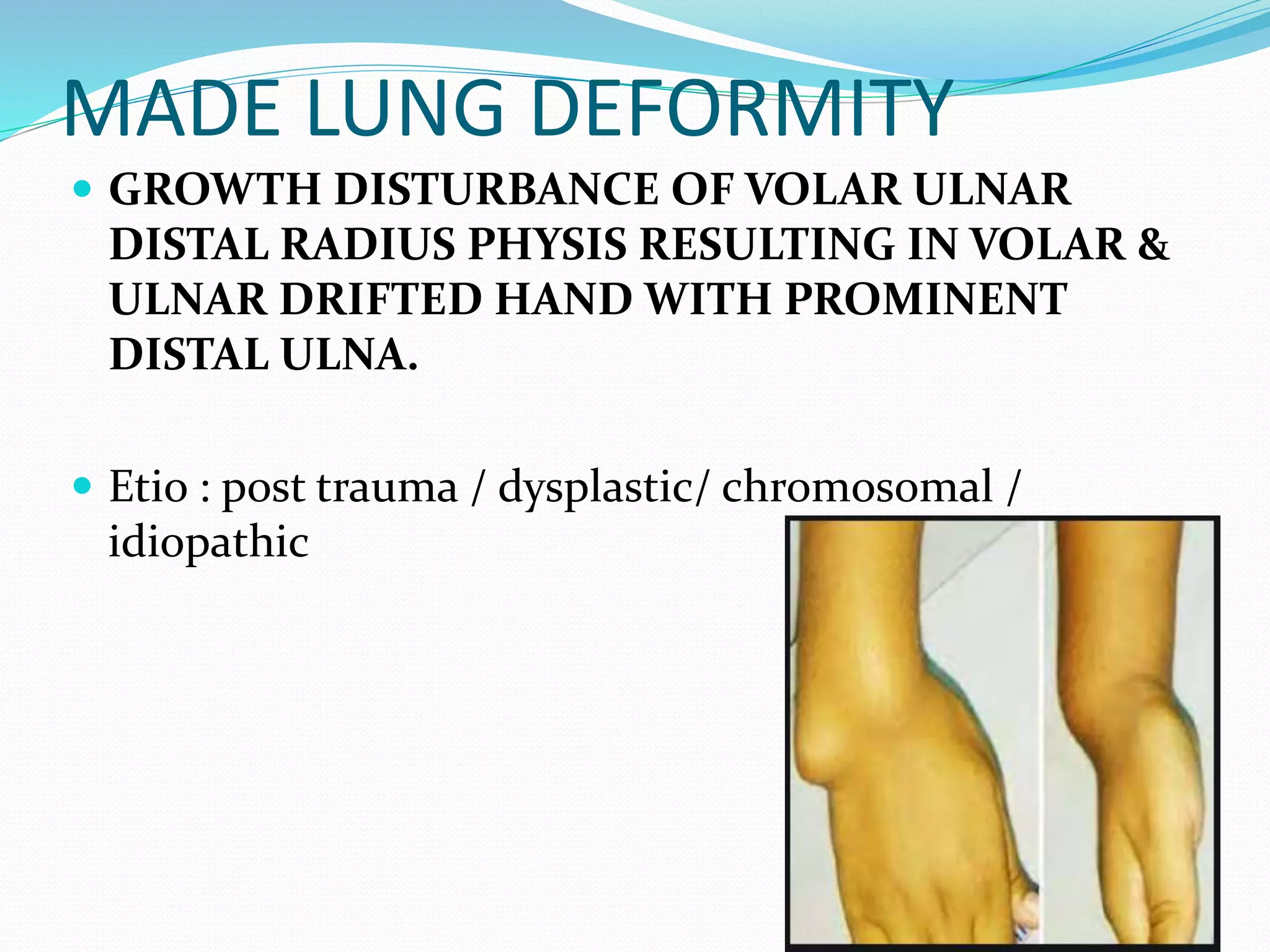 Congenital skeletal limb deficiences | PPTX
