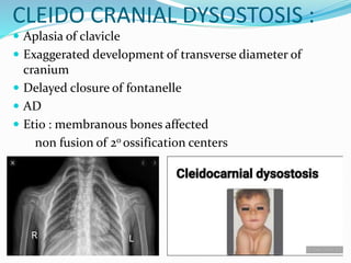 Congenital skeletal limb deficiences | PPTX