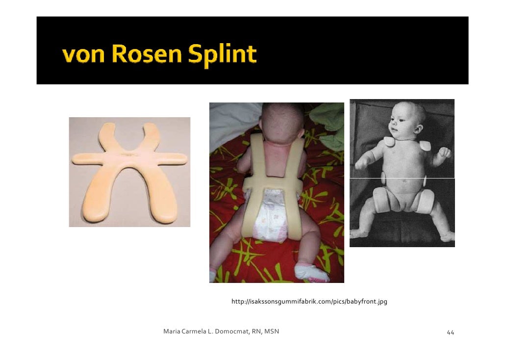 Congenital skeletal malformations