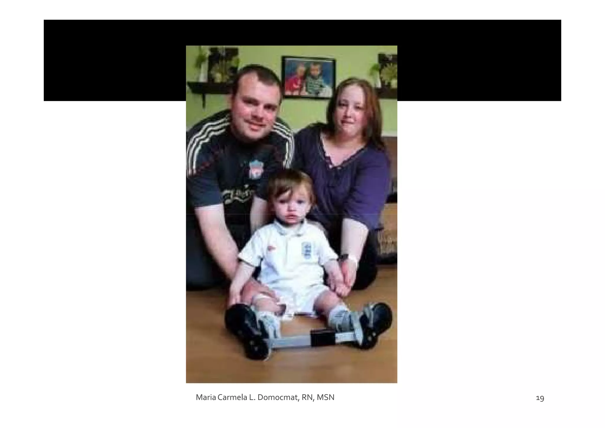 Musculoskeletal disorders Part 8 Congenital skeletal malformations | PDF