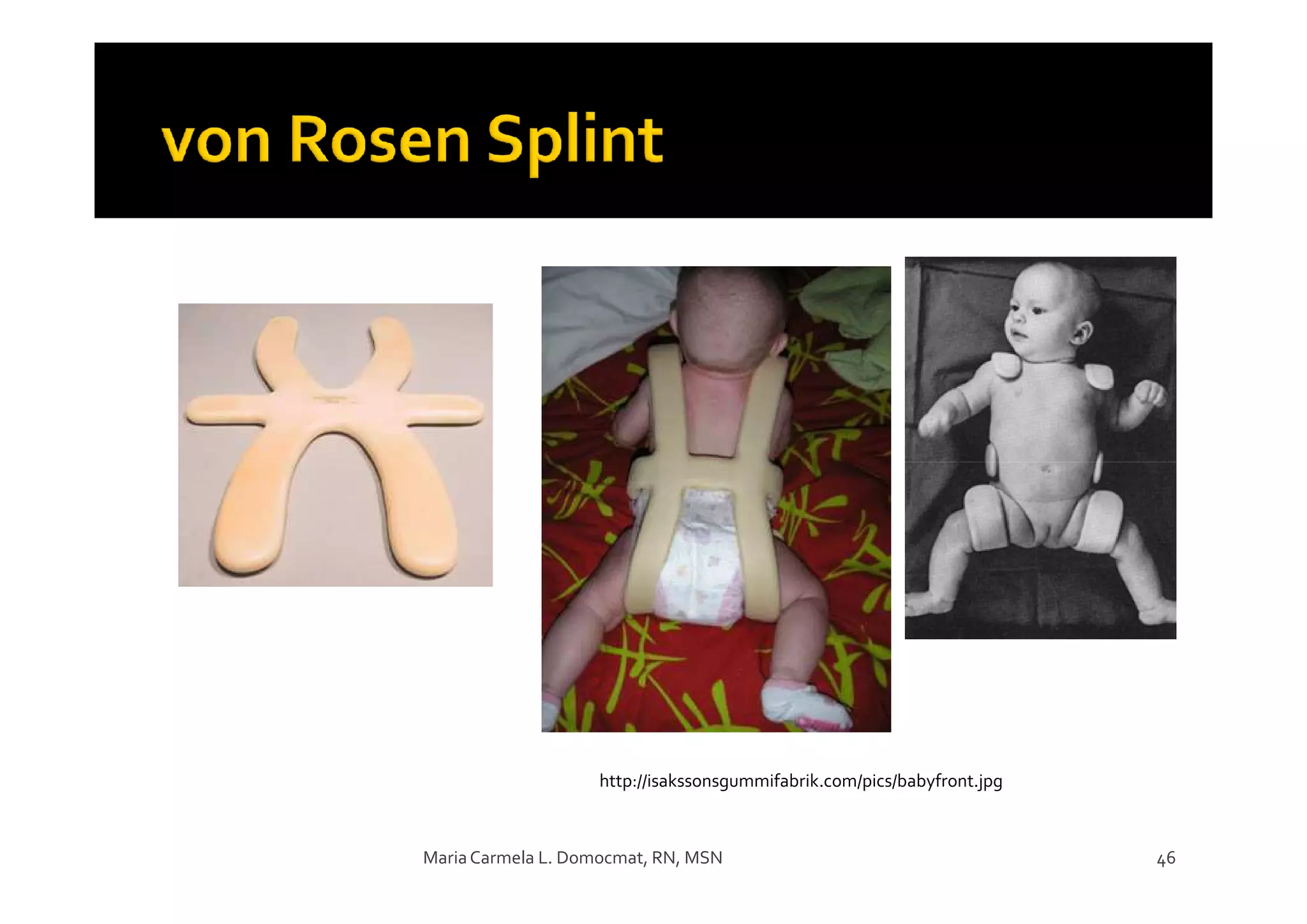 Musculoskeletal disorders Part 8 Congenital skeletal malformations | PDF