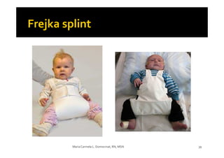 Frejka Splint