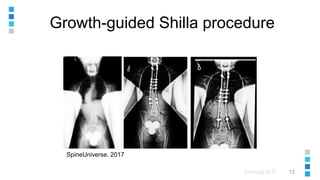 Physiotherapy for Congenital Spine Deformities | PPTX