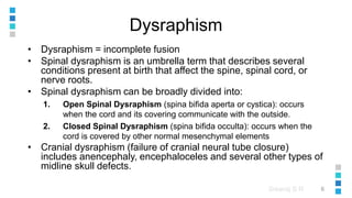 Physiotherapy for Congenital Spine Deformities | PPTX