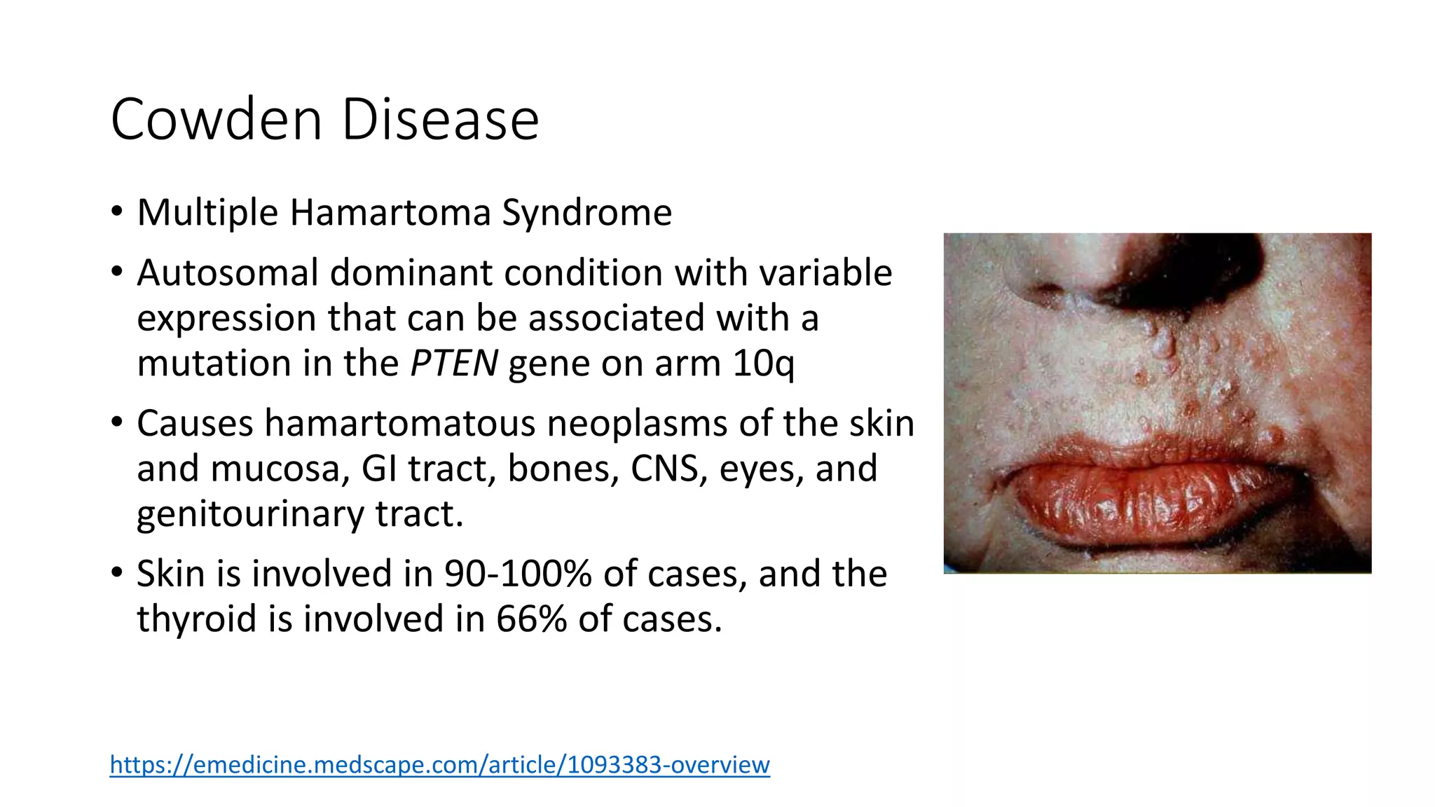 Congenital syndromes and cancer1 | PPTX