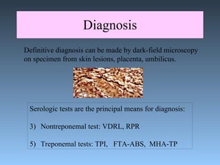 Congenitalsyphilis | PPT