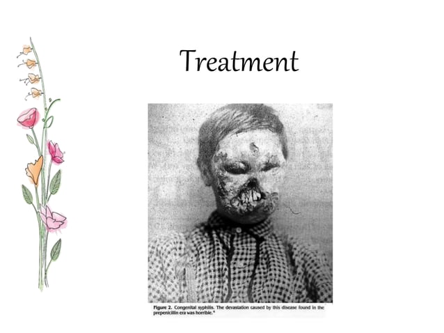 Congenital syphilis | PPT